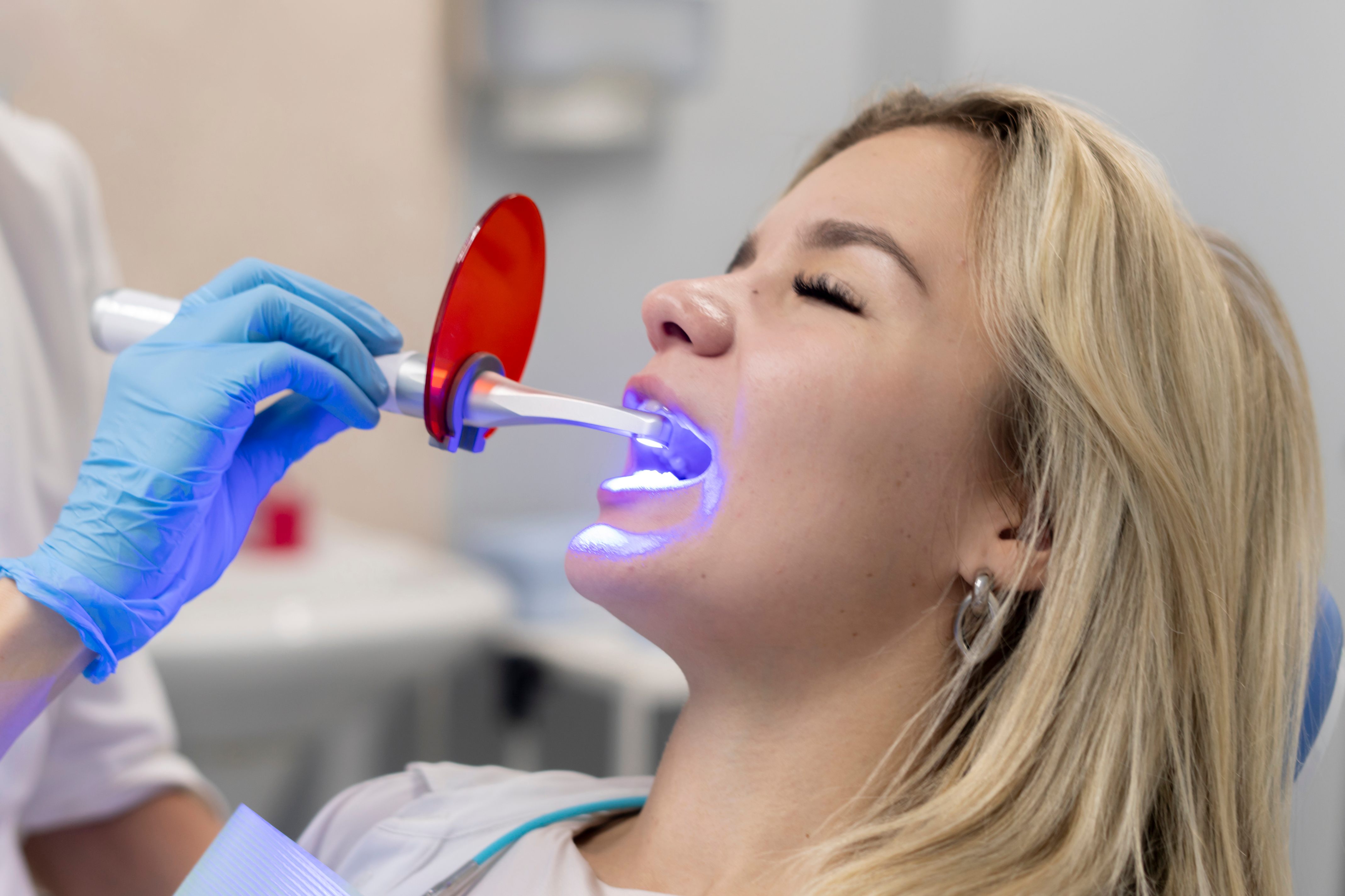 Teeth Whitening Options | Choose Between At-Home vs. In-Office